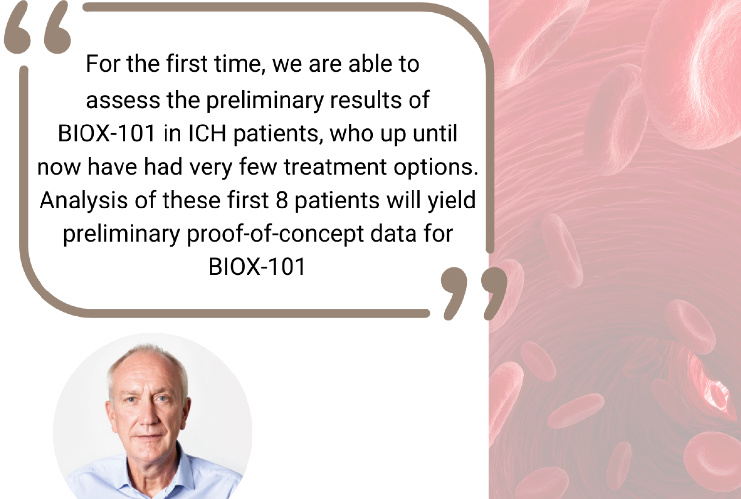 A breakthrough for hemorrhagic stroke patients. | Bioxodes